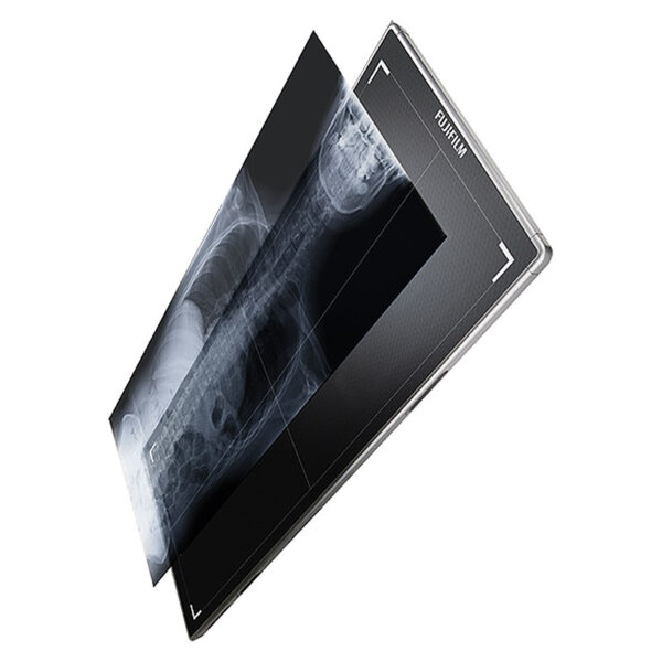 Medical Digital Radiography Systems | Fuji DR - White Mountain Imaging